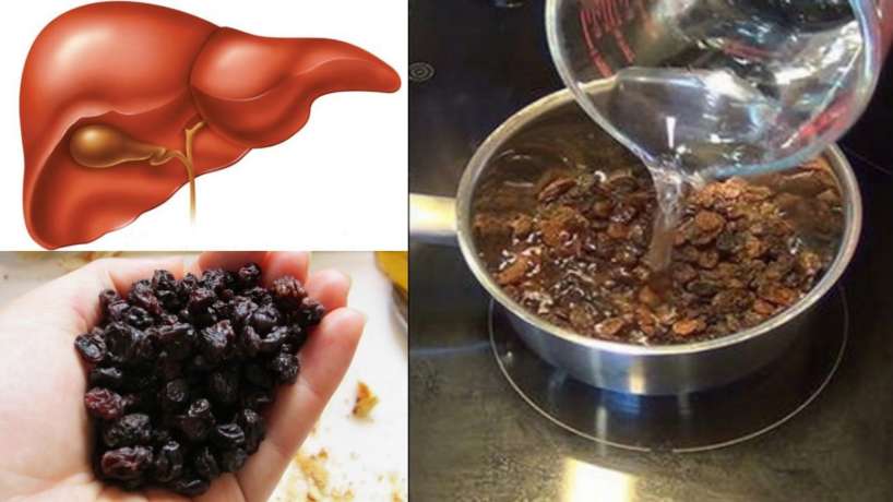 Pat ārsti par to ir izbrīnīti - Rozīnes un ūdens attīra aknas vien 2 ...